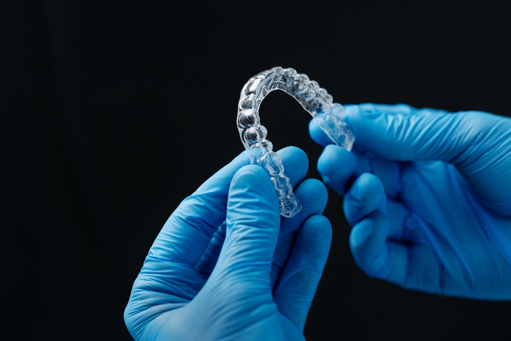Invisalign Buttons: The Tiny Tools That Make a Big Difference in Teeth ...